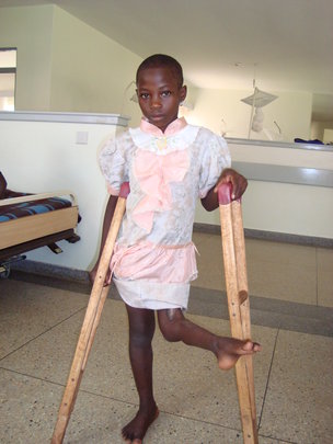 Give 40 Children in Asia the Ability to Walk! - GlobalGiving