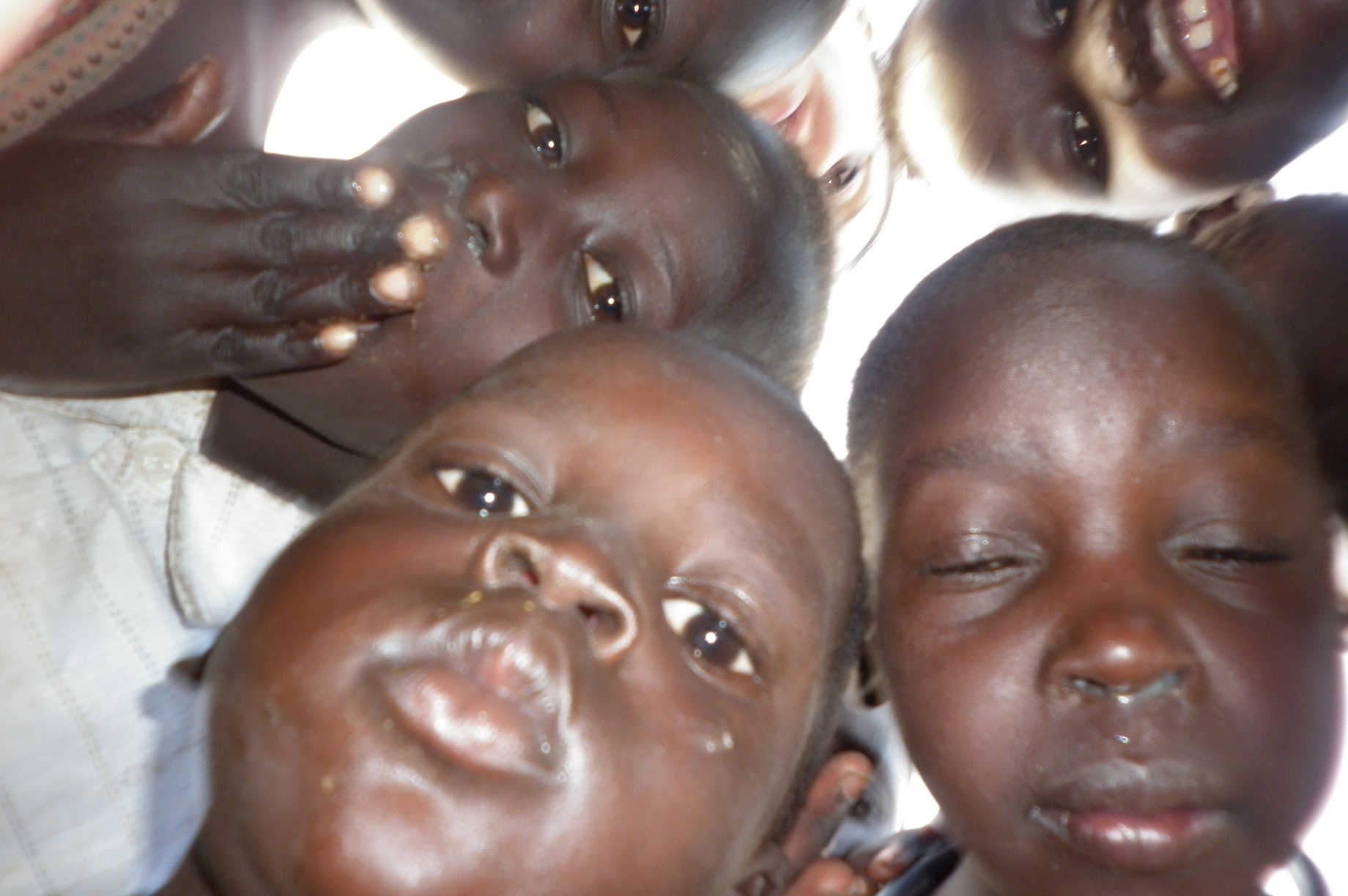 Nutrition Clinic for 500 Children of Juba's Slums - GlobalGiving