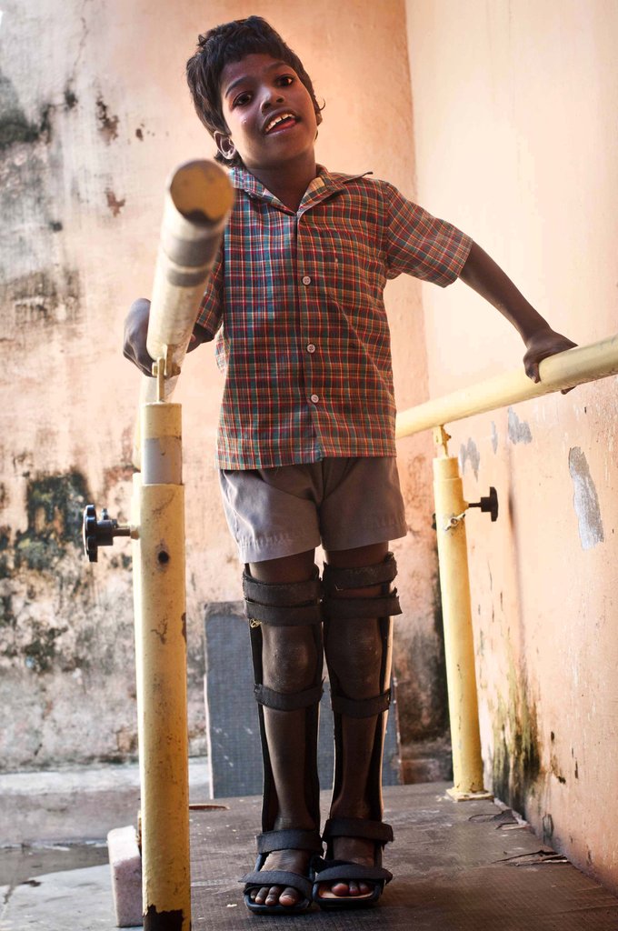 Help 45 Mentally Challenge& Cerebral Palsied child - GlobalGiving