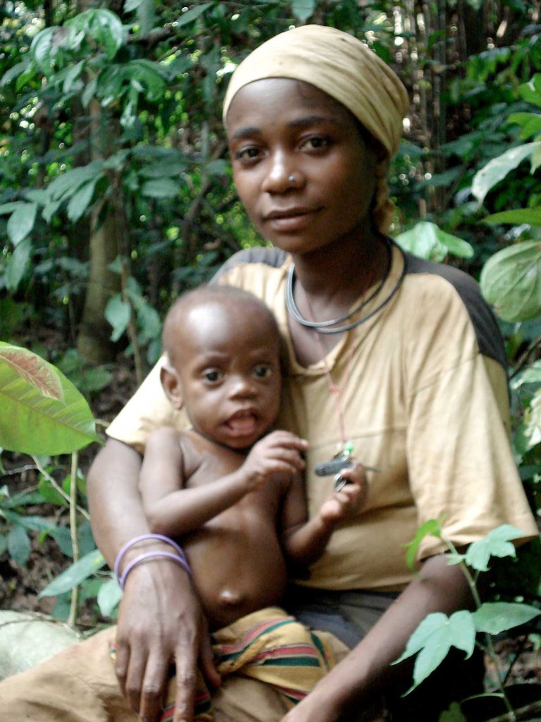 Improving the health of an indigenous Baka village - GlobalGiving