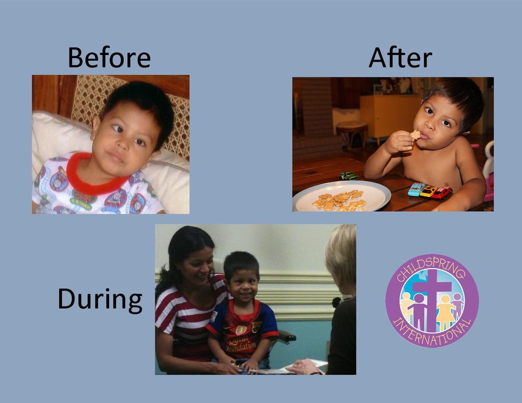 Change A Child's Life Forever - GlobalGiving