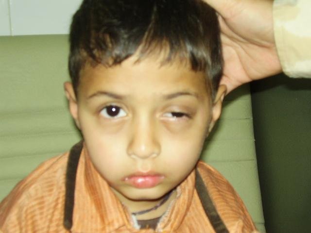 Giving Sight to the Cataract Blind - GlobalGiving