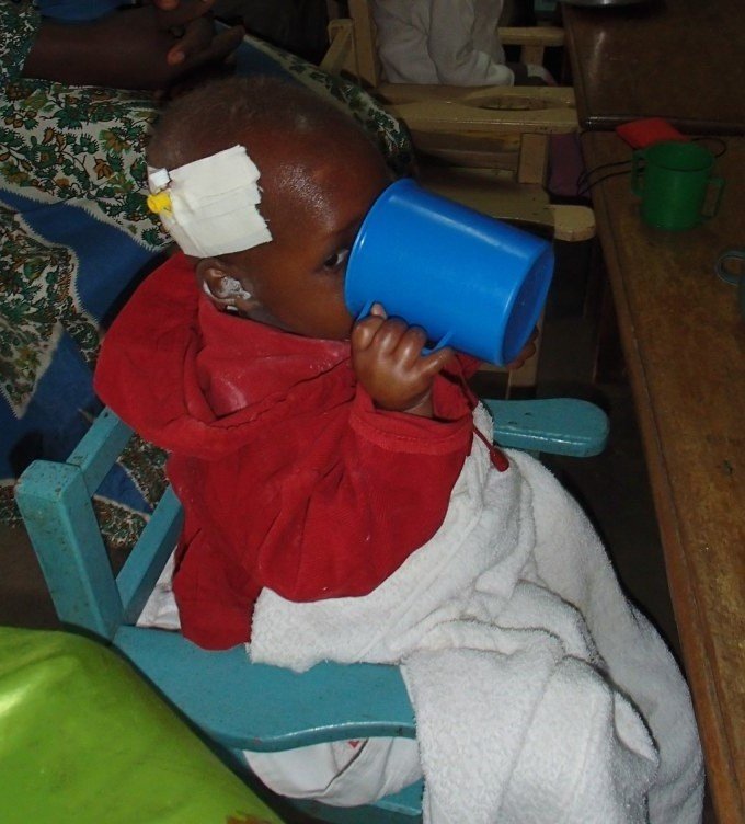 Feeding 300 Severely Malnourished Children. - GlobalGiving