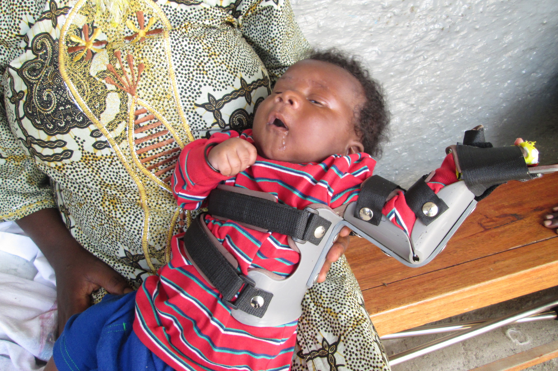 Rehabilitate 70 children handicap in Burundi - GlobalGiving