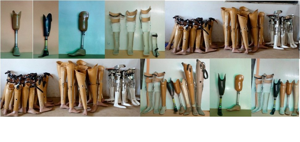 To provide 250 Free Artificial Limbs to Amputees - GlobalGiving