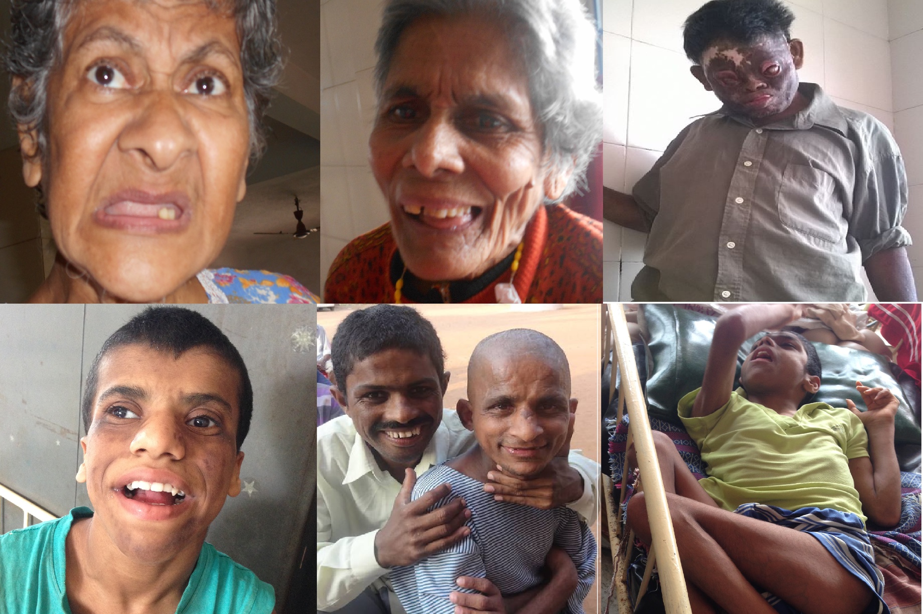 Food and Medicines for 285 Disabled destitute - GlobalGiving