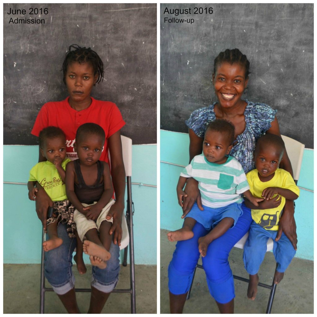 Save the Life of a Malnourished Child - GlobalGiving