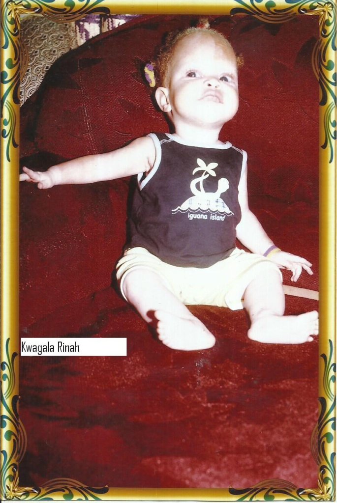 Build a School for 200 Children with Albinism - GlobalGiving