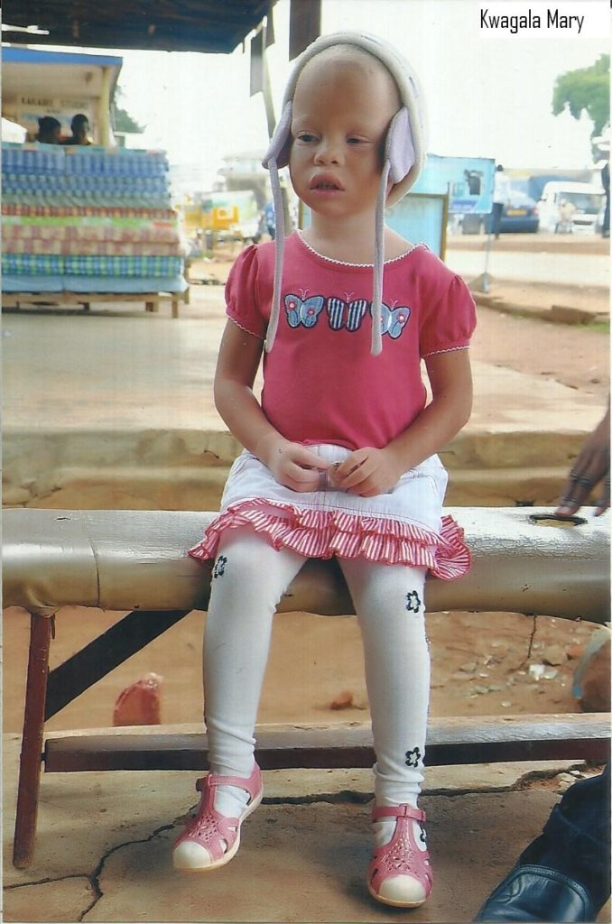 Build a School for 200 Children with Albinism - GlobalGiving