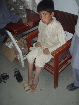 Make 200 disabled Pakistani people be independent - GlobalGiving