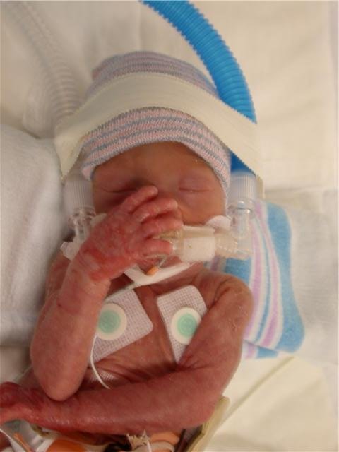 Help America's Special Needs & Autistic Infants - GlobalGiving