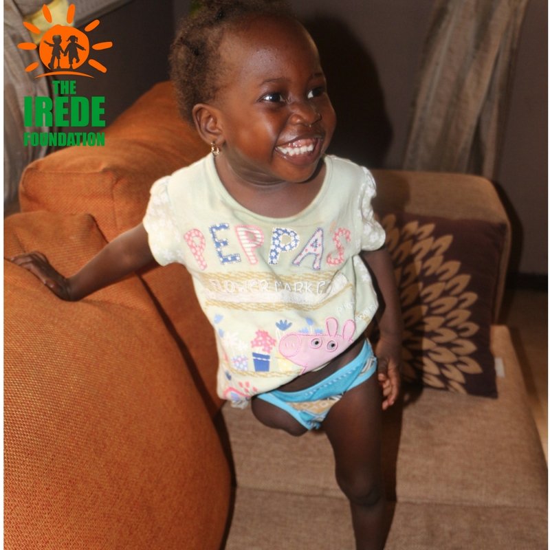 Provide Limbs to 20 Child Amputees in Nigeria - GlobalGiving