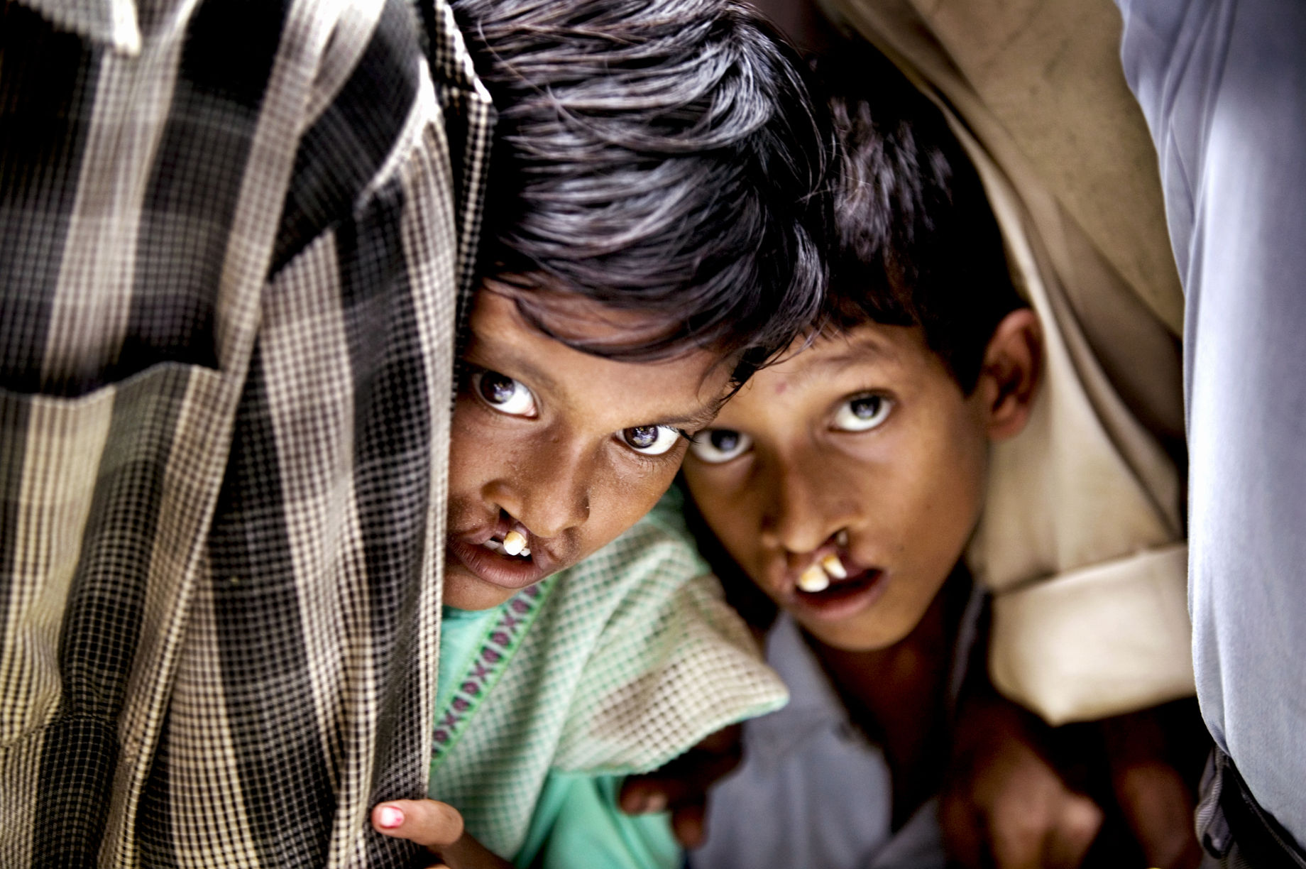 Give Cleft Babies A Chance To Smile - GlobalGiving