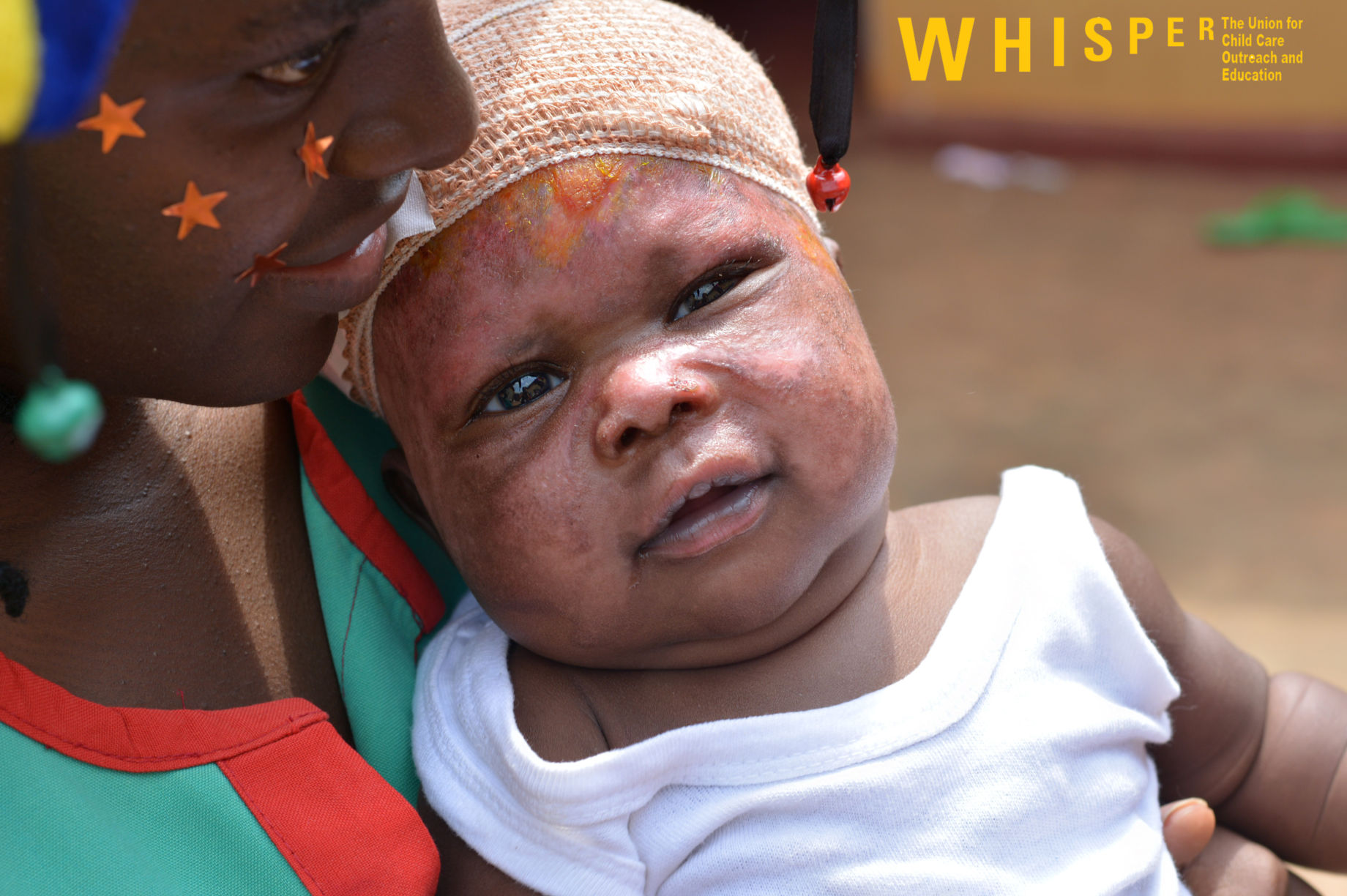 Help Fund a Children's Burn Unit in Uganda - GlobalGiving