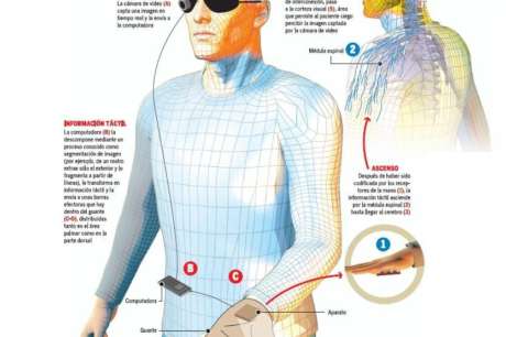 Human Artificial Vision. Prosthesis for the blind. - GlobalGiving
