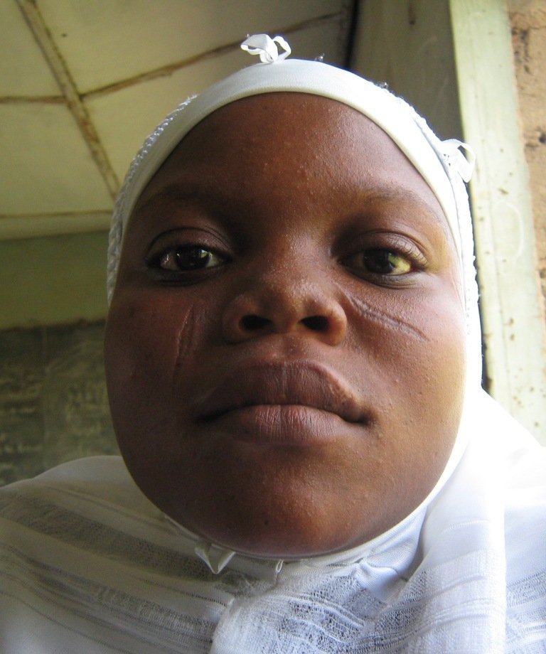 Eradication Of Facial Mutilation In Moro LGA,Kwara - GlobalGiving