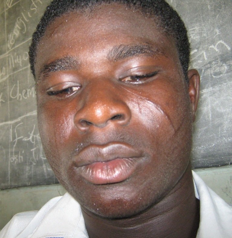How to Share Eradication Of Facial Mutilation In Moro LGA,Kwara ...