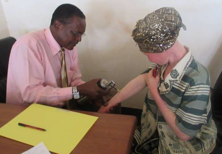 End skin cancer for people with albinism in Uganda - GlobalGiving