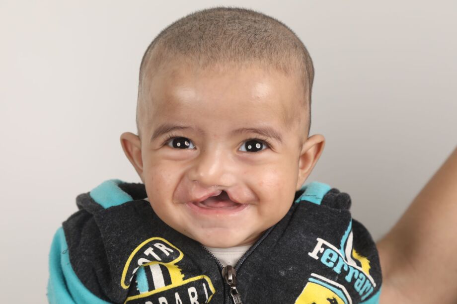 Help 10 Children Born with Cleft in Lebanon/MENA - GlobalGiving
