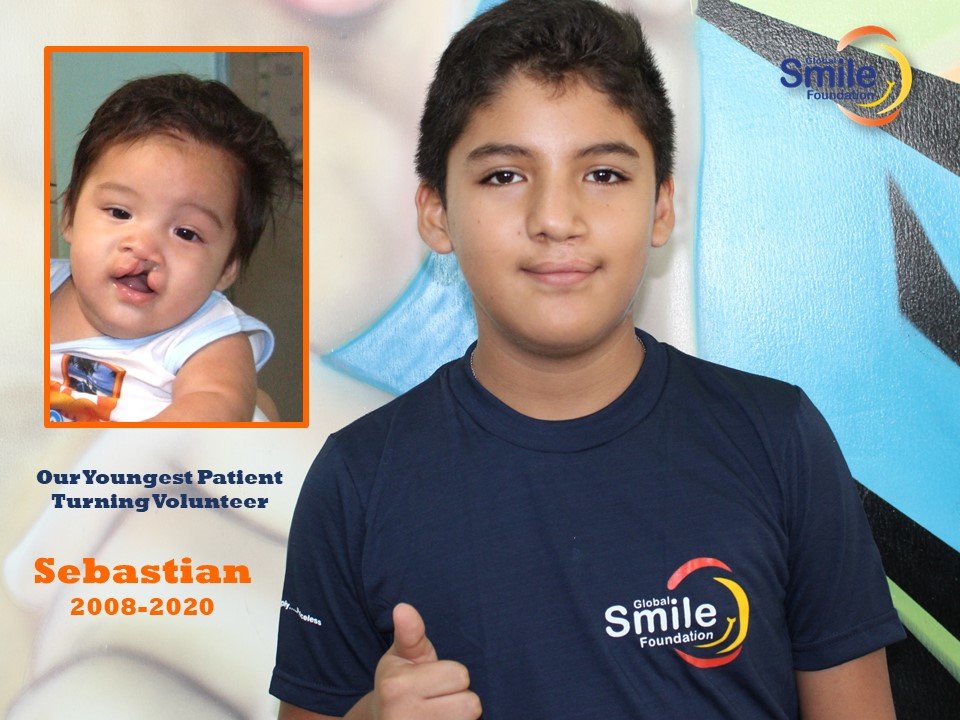 Saving Lives for Children born with Cleft - GlobalGiving