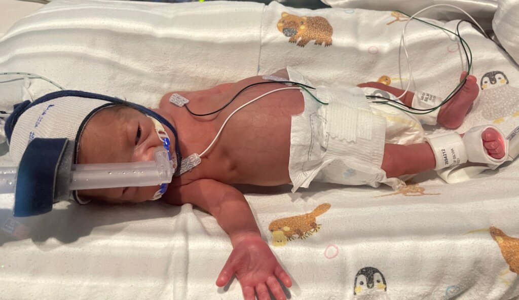 Mercy Health Neonatal Services - GlobalGiving