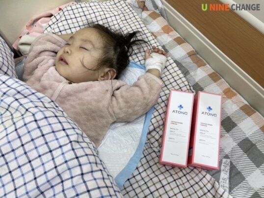 Treatment support for burn children in Mongolia - GlobalGiving