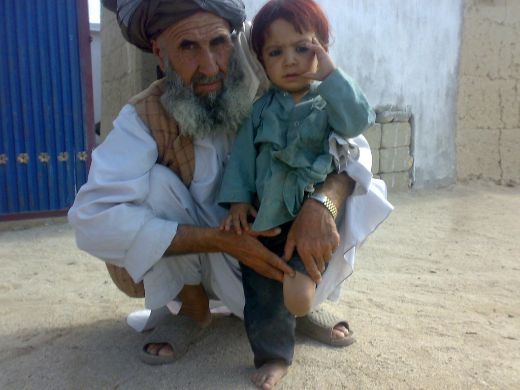 Reports on Help a Landmine Victim Walk Again - GlobalGiving