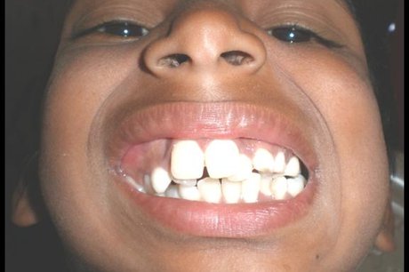 treat 200 patients with facial deformities - GlobalGiving
