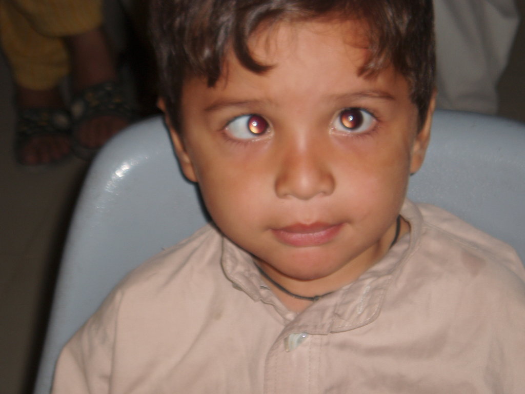 Reports on Help the poor blind children in Pakistan See! - GlobalGiving