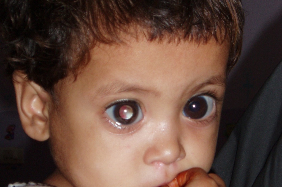 Reports on Help the poor blind children in Pakistan See! - GlobalGiving